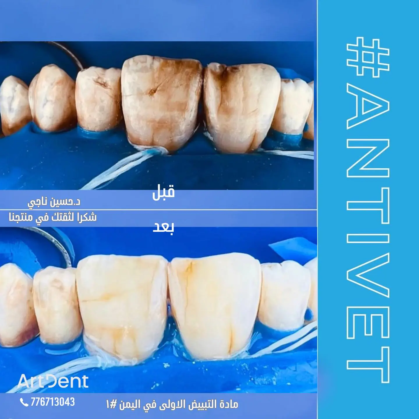 Dr.Hussein Naji | ARTDENT